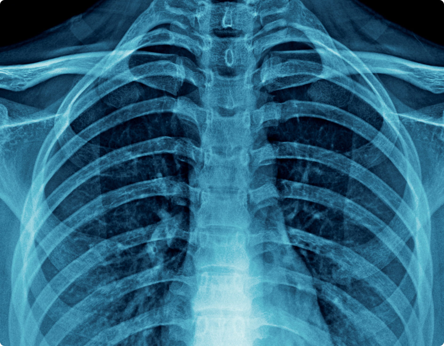 Acute Pain Trials CRO | Fast, Coordinated Execution | Rho